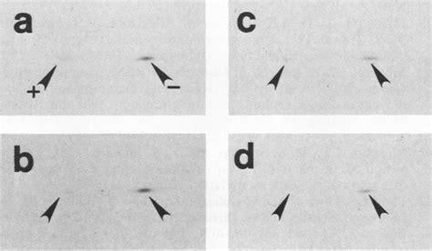 Two Dimensional Gel Analysis Of Hprt Polypeptides Immunoprecipitated