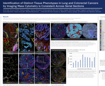 Phenoplex Interactive Multiview Analysis Visiopharm Pathology