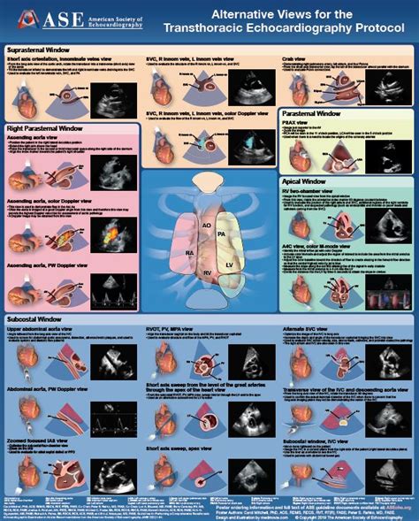 Comprehensive Tte Guideline Poster Bundle 4 Posters