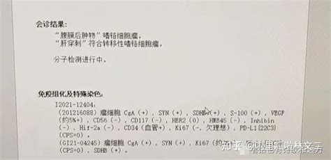 钻石哥收集经典病例分享：嗜铬细胞瘤 1 知乎