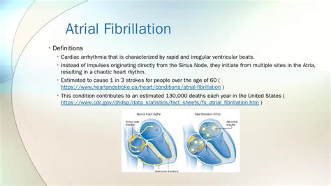 deep learning applications for atrial fibrillation detection in ecg