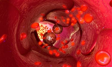 Identifying Circulating Tumour Cells With Liquid Biopsy • Healthcare In