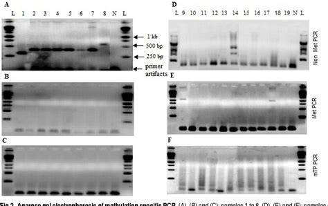 Pdf Cascade Screening For Fragile X Syndromecgg Repeat Expansions In