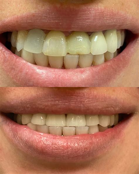 Tk Dental Wayne Dentists Wayne Nj Dr Tatyana Kaminar Dds