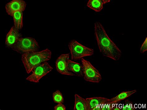 Cdk8 Antibody 83621 6 Pbs Proteintech