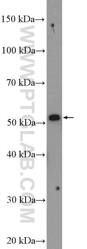 Serping1 C1 Inactivator Antibody 12259 1 Ap Proteintech