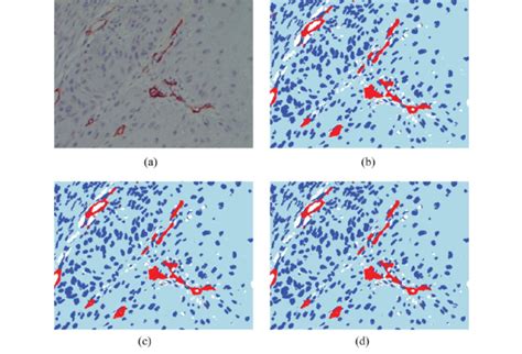 Comparing The Fully Automatic Semiautomatic And Manual Methods A