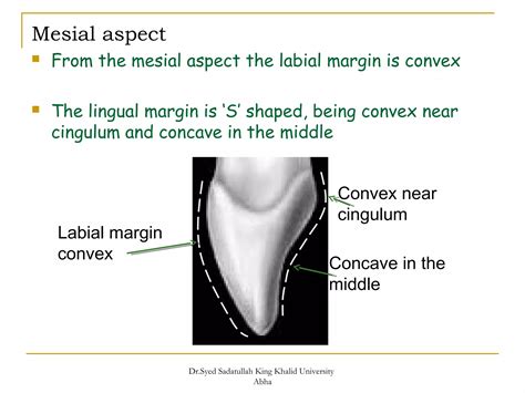 Morphology Of Maxillary Central And Lateral Incisors Teeth Ppt