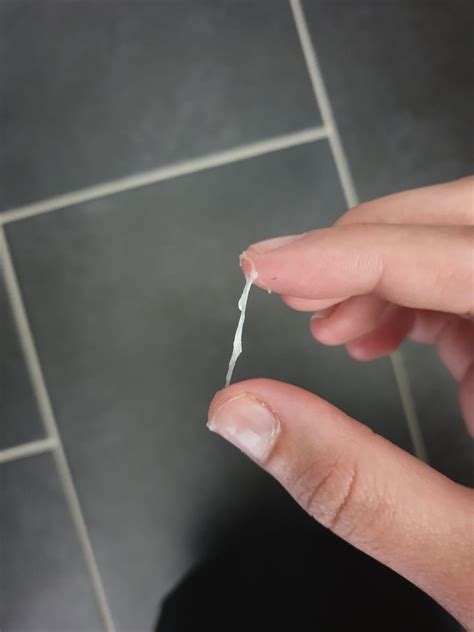 VORSICHT BILD VOM ZERVIXSCHLEIM Forum Kinderwunsch Urbia De