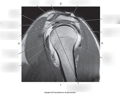 T1 Sagittal Oblique Shoulder Diagram Quizlet