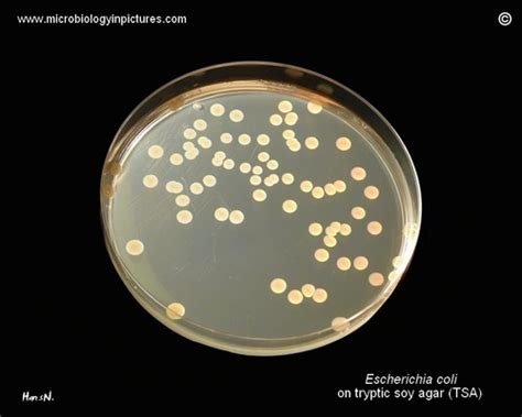 Lab 4 Ubiquity Of Microorganisms And Colony Morphology Flashcards Quizlet