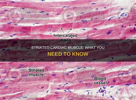 Striated Cardiac Muscle What You Need To Know Cyvigor