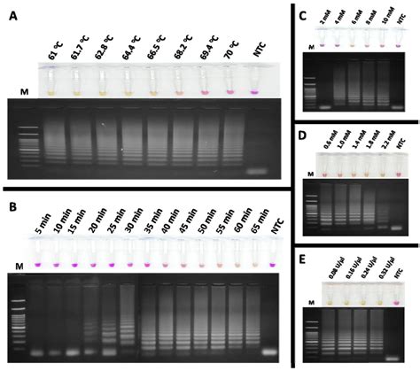 Colorimetric Reverse Transcription Loop Mediated Isothermal Amplification With Xylenol Orange