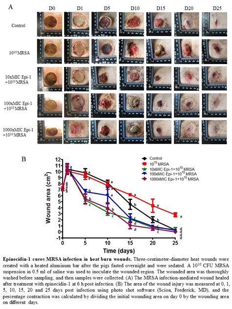 石斑魚抗菌胜肽epinecidin 1 應用於燒燙傷之藥物開發 以哺乳類為研究模式 Future Tech Pavilion