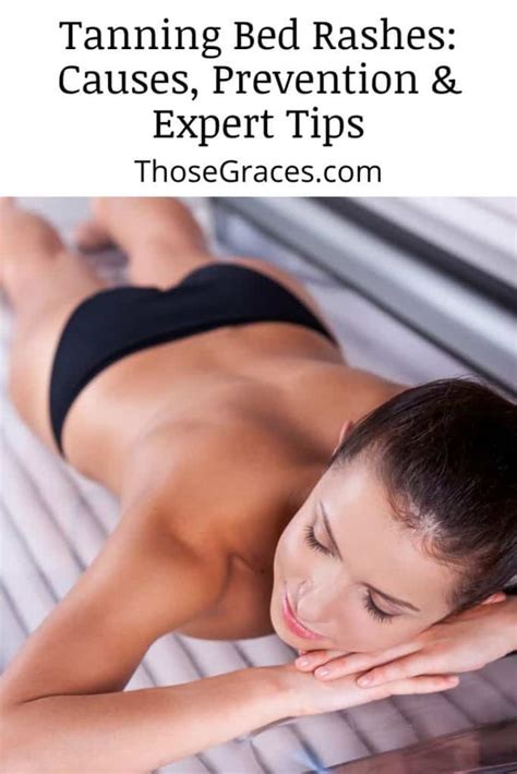 Tanning Bed Rashes Causes Prevention And Expert Tips