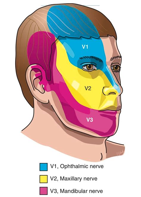 Neuralgia Nevralgia do Trigêmeo Neurologia Integrada