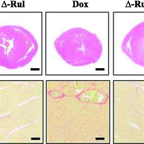 Dox Induced Cardiac Injury Scale Bar Of Hande Staining Is 1 Mm Scale