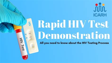Rapid Hiv Test Same Day Results At Julia Belcher Blog