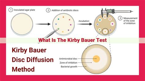 Kirby Bauer Test Accurately Assessing Bacterial Susceptibility For Optimal Antibiotic Selection