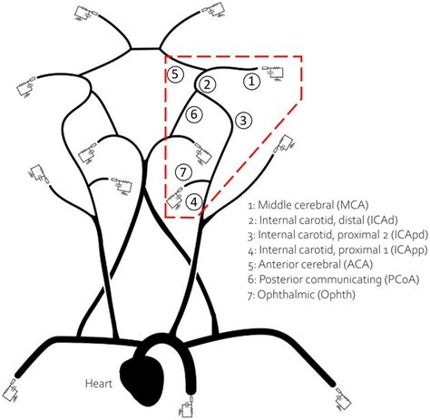 The Network Used In This Study The Inlet Boundary Condition Is Applied