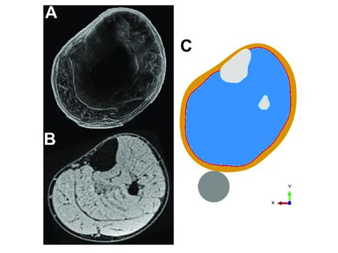 2 Finite Element Fe Model Implementation B Mode Ultrasound Download Scientific Diagram