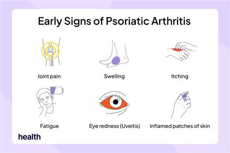 Early Psoriatic Arthritis Psa Signs And Symptoms