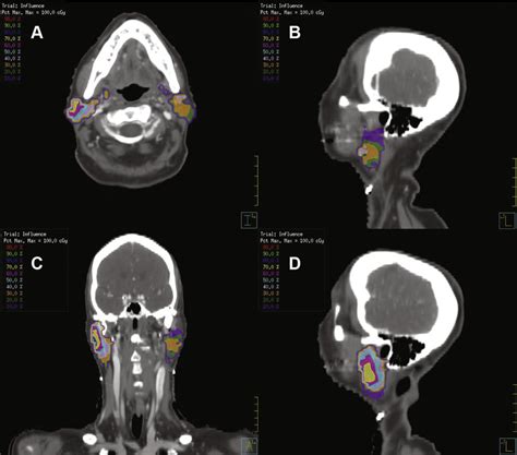 Two Dimensional Cross Sectional Images From Computed Tomography Scans