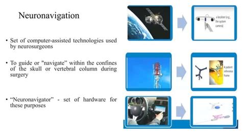 Application Of Neuronavigation In Brain Surgery Ppt