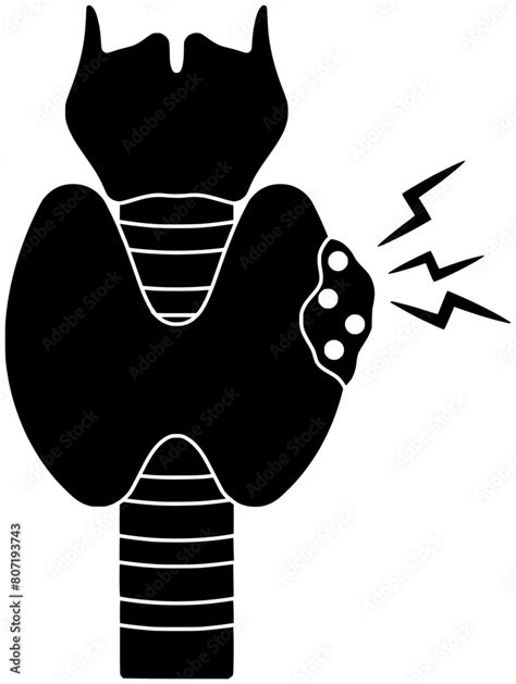 Biology Illustration Anatomy Silhouette Thyroid Logo Structure Icon Organ Outline Anatomical