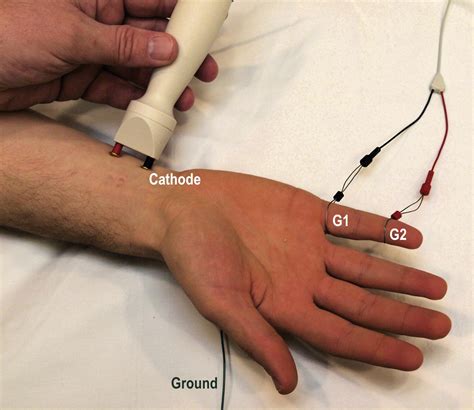 Routine Upper Extremity Facial And Phrenic Nerve Conduction