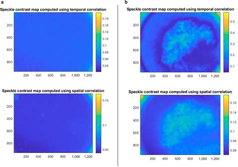 Applications Of Laser Speckle Contrast Imaging Technology In