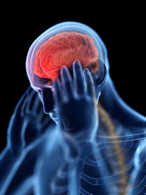 What Is Cte Disease Information Causes Treatment And Prevention