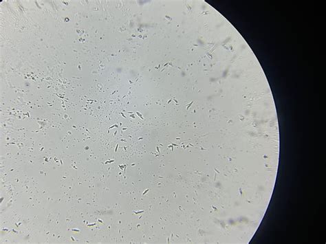 Does Male Precum Contain Sperm Microscope Photos Rsemenretention2