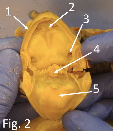 Frog Dissection 24 Diagram Quizlet