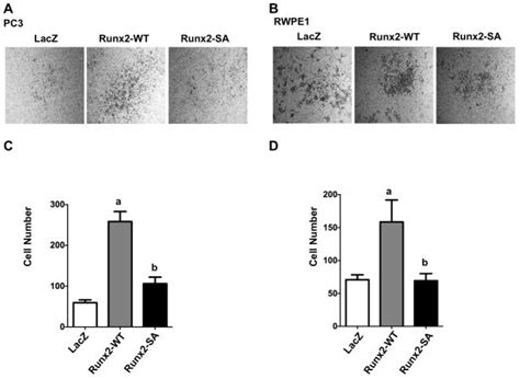 Role Of Runx2 Phosphorylation In Prostate Cancer And Association With