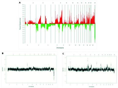 a genome wide frequency plot of dna copy number gains red and losses