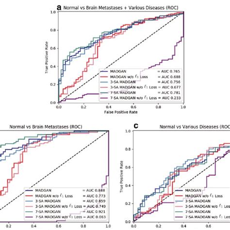 Unsupervised Anomaly Detection Results Using Average ℓ 2 Loss Per Scan Download Scientific