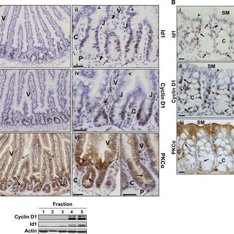 Id1 Expression Inversely Correlates With Pkc Activation In The