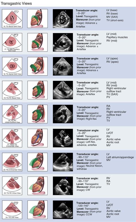 Transesophageal Echocardiography Tomographic Views Clinical Tree