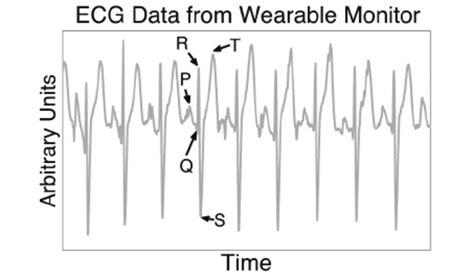 Sample ECG Data Over A Few Seconds While The Subject Was Doing Light Download Scientific