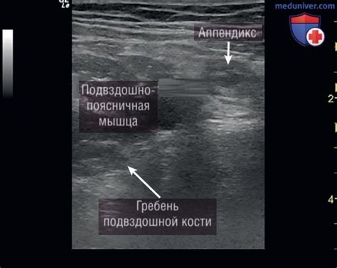 УЗИ в педиатрии у постели больного (на месте, point-of-care)