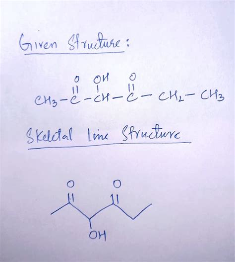 Solved How To Draw Skeletal Line Draw A Skeletal Line