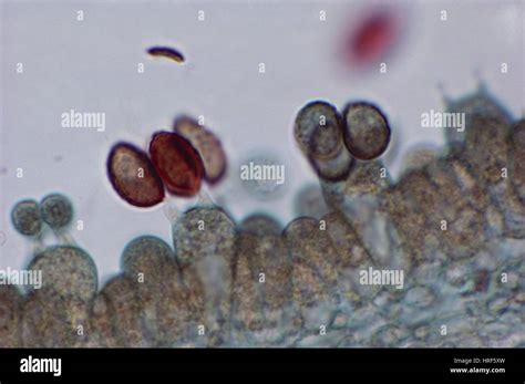 Coprinus Basidium