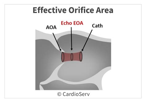 Aortic Orifice