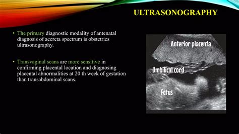 Placenta Accreta Spectrum Disorderspptx