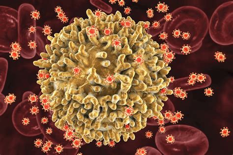 HIV Control Criteria Overview Expert Roundtable Infectious Disease