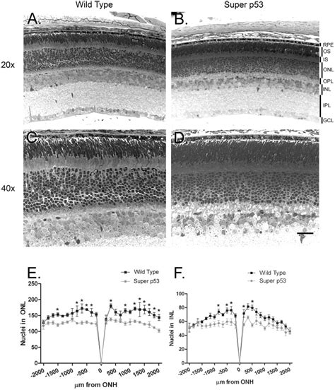 Light Micrographs Of Retinal Cross Sections Taken From Wild Type Aandc