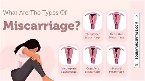 Miscarriage What Does A Miscarriage Look Like Signs Of Miscarriage And More
