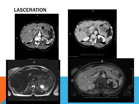 Quick Review Of Hepatobiliary And Pancreatic Lesion Ppt