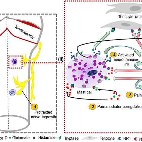 Schematic Illustration Of Pathophysiology In Chronic Tendon Pain In